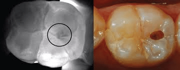 Latest Technology - Cherry Hills Dental